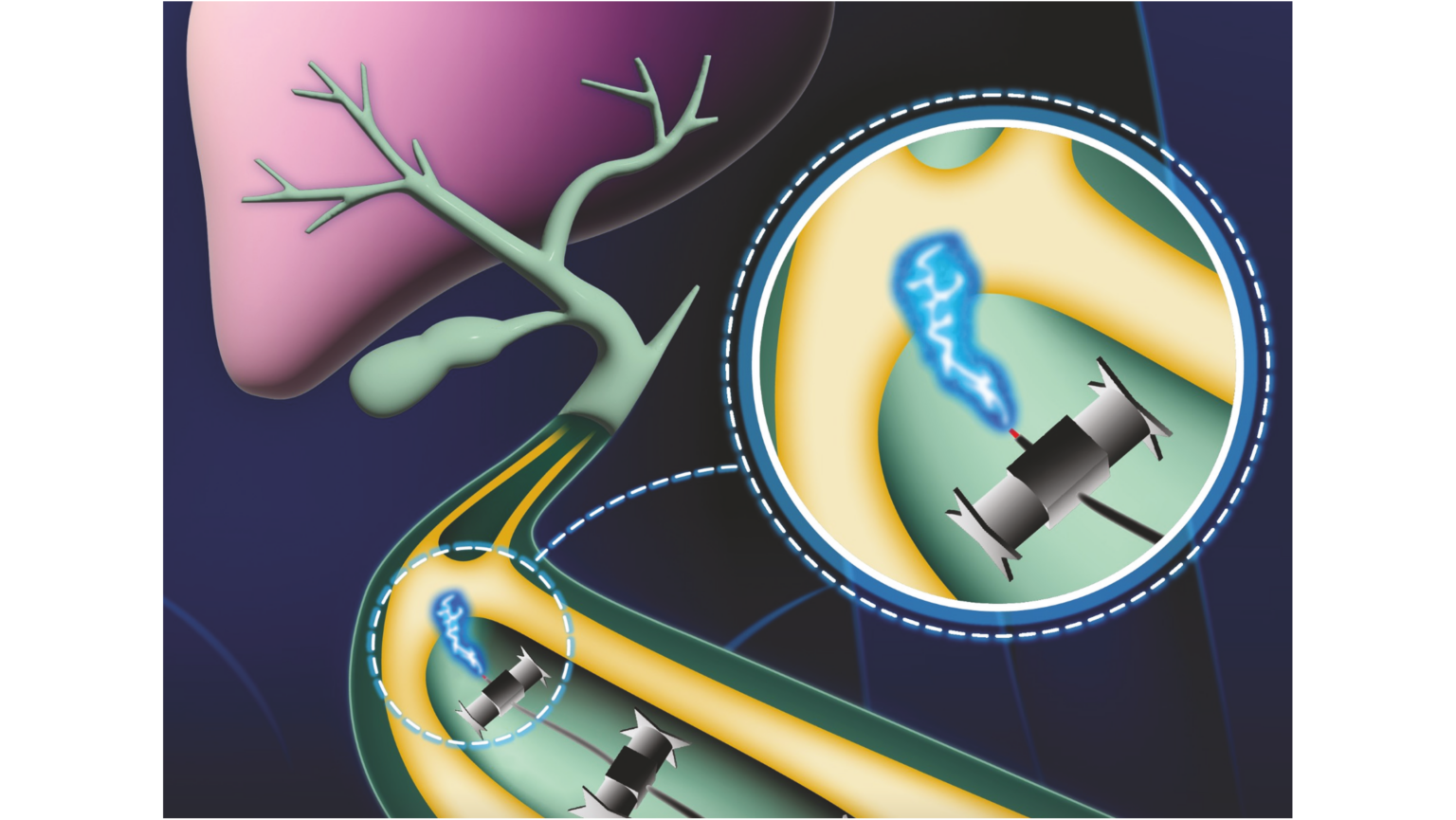 Stronger together: miniature robots in convoy for endoscopic surgery ...