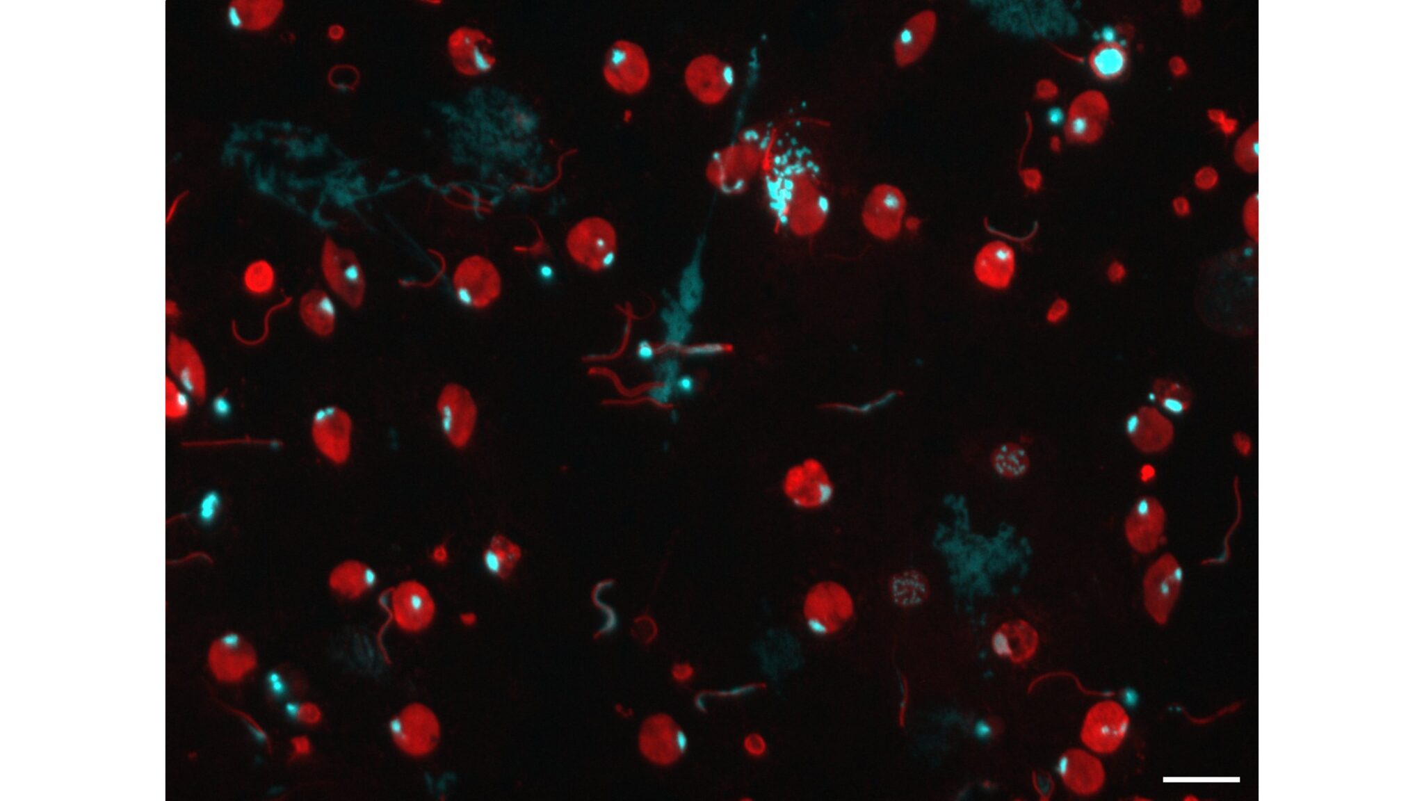 KEY PROTEINS FOR MALARIA REPRODUCTION FOUND IN THE MOSQUITO - BioRN ...